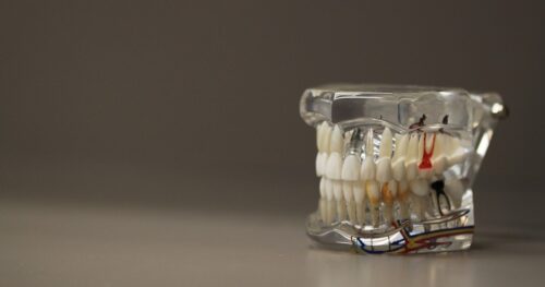 【顎恐怖症】二重顎やシャクレが怖い？その心理とは？ | 心理学・スピリチュアル研究所